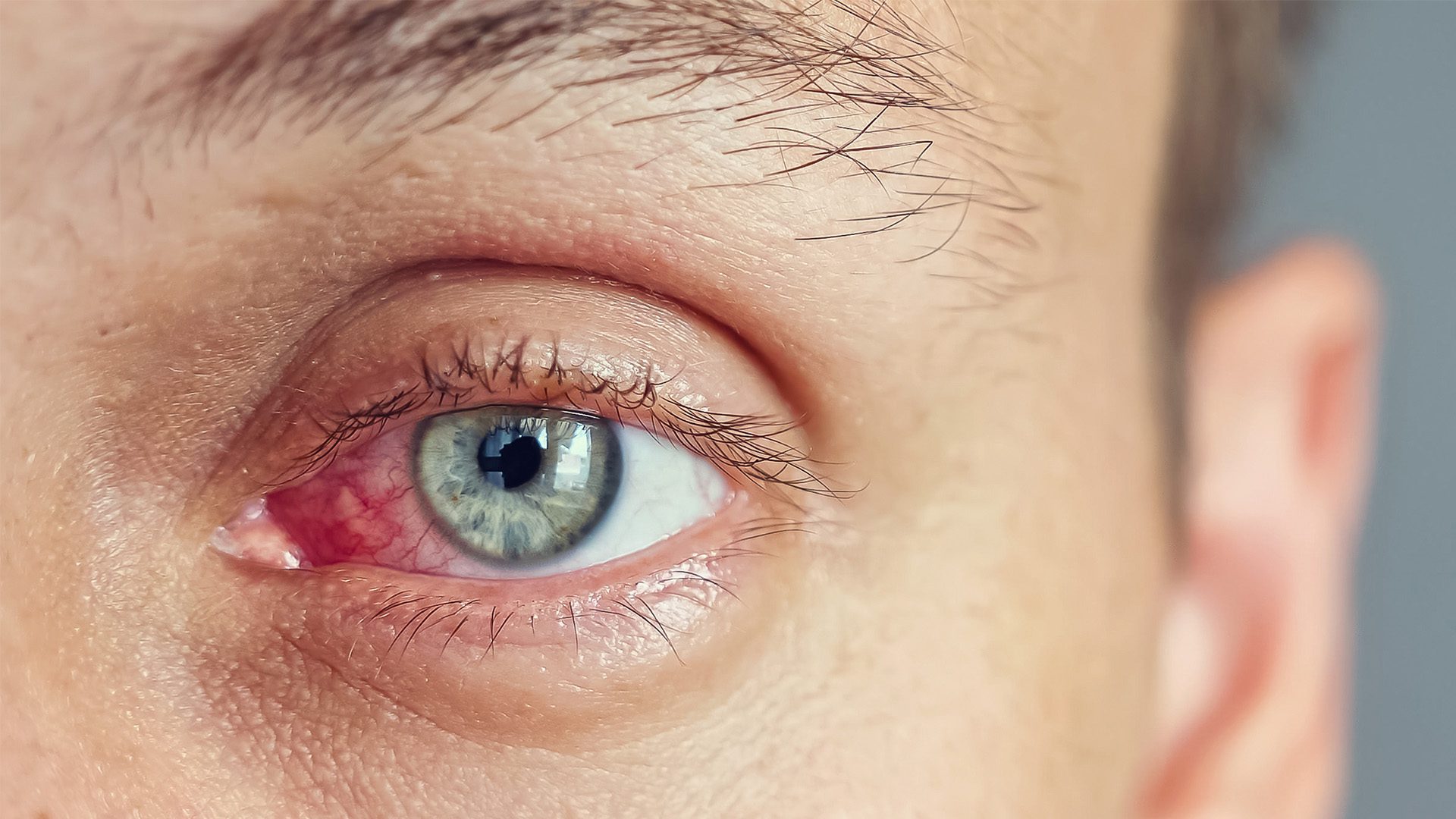 Where Eye-Area Wellness Meets Natural Rejuvenation